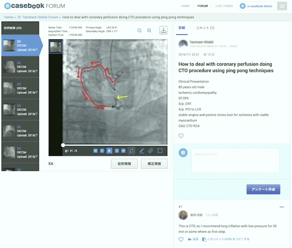 【レポート】AWS を駆使して実現する e-casebook の医用画像ビューアと手術映像ライブストリーミング #AWSSummit | DevelopersIO